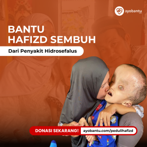 BANTU HAFIZD SEMBUH DARI HIDROSEFALUS