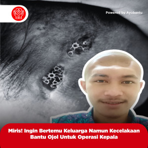 BANTU OJOL OPERASI KEPALA
